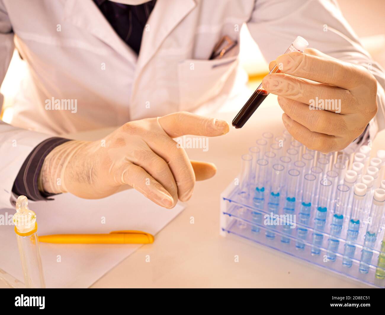 Modern laboratory. Researcher's hands close up. Doctor examines a test ...