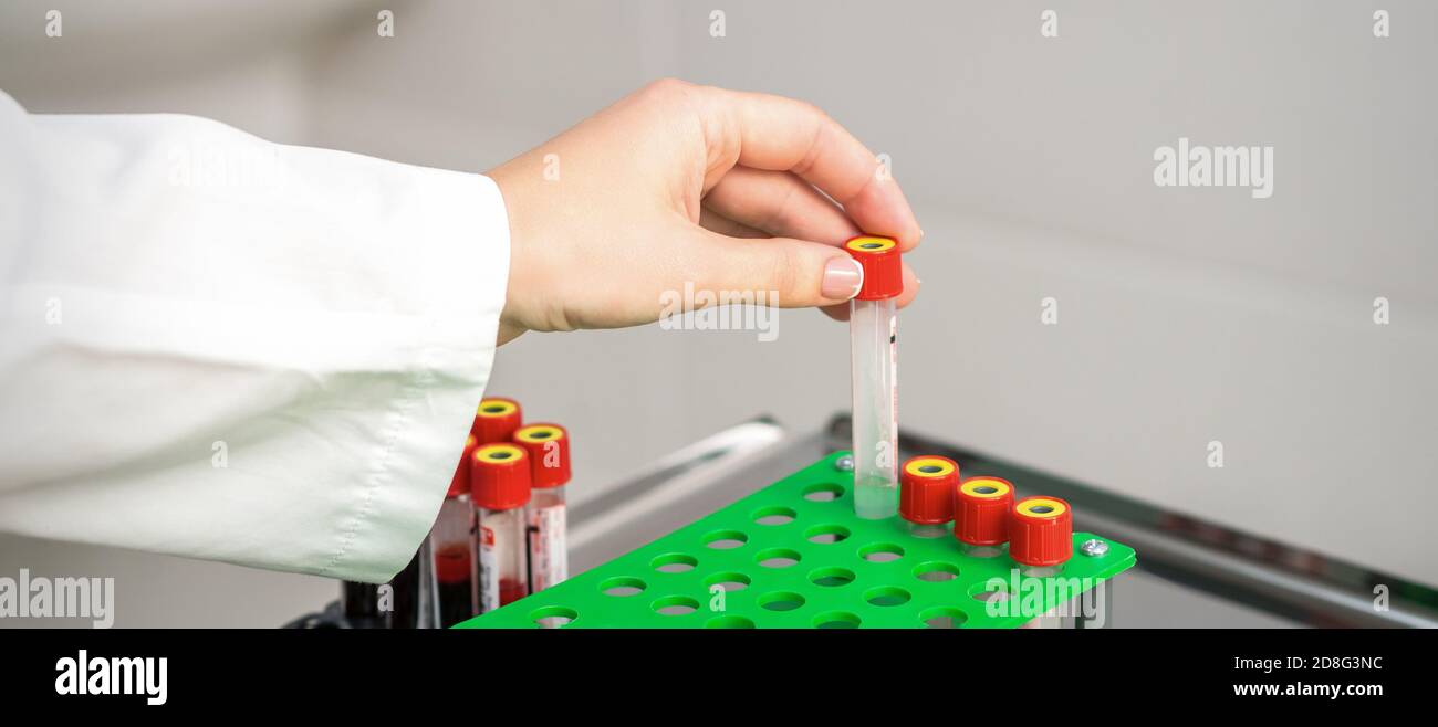 Test tube rack empty hi-res stock photography and images - Alamy