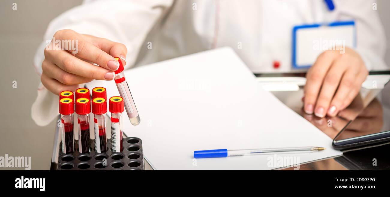 Analysing blood plasma lab hi-res stock photography and images - Alamy