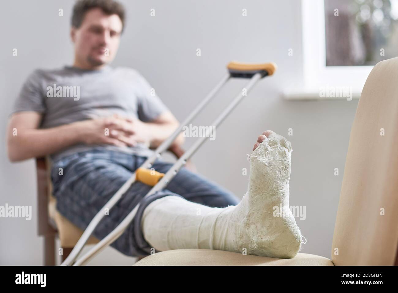 Close up of a young man's Plaster leg cast and after a running injury ...