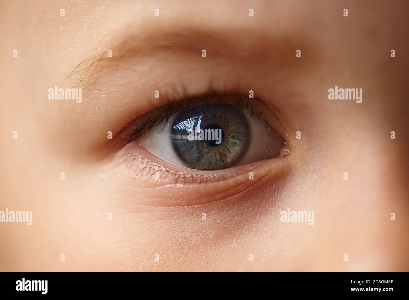 Close up of baby eye looking at camera. Medical diagnosis ...