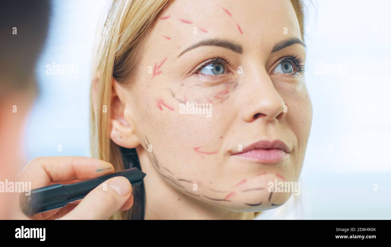 Close-up Shot of the Beautiful Female Face and Plastic Cosmetic Surgeon ...