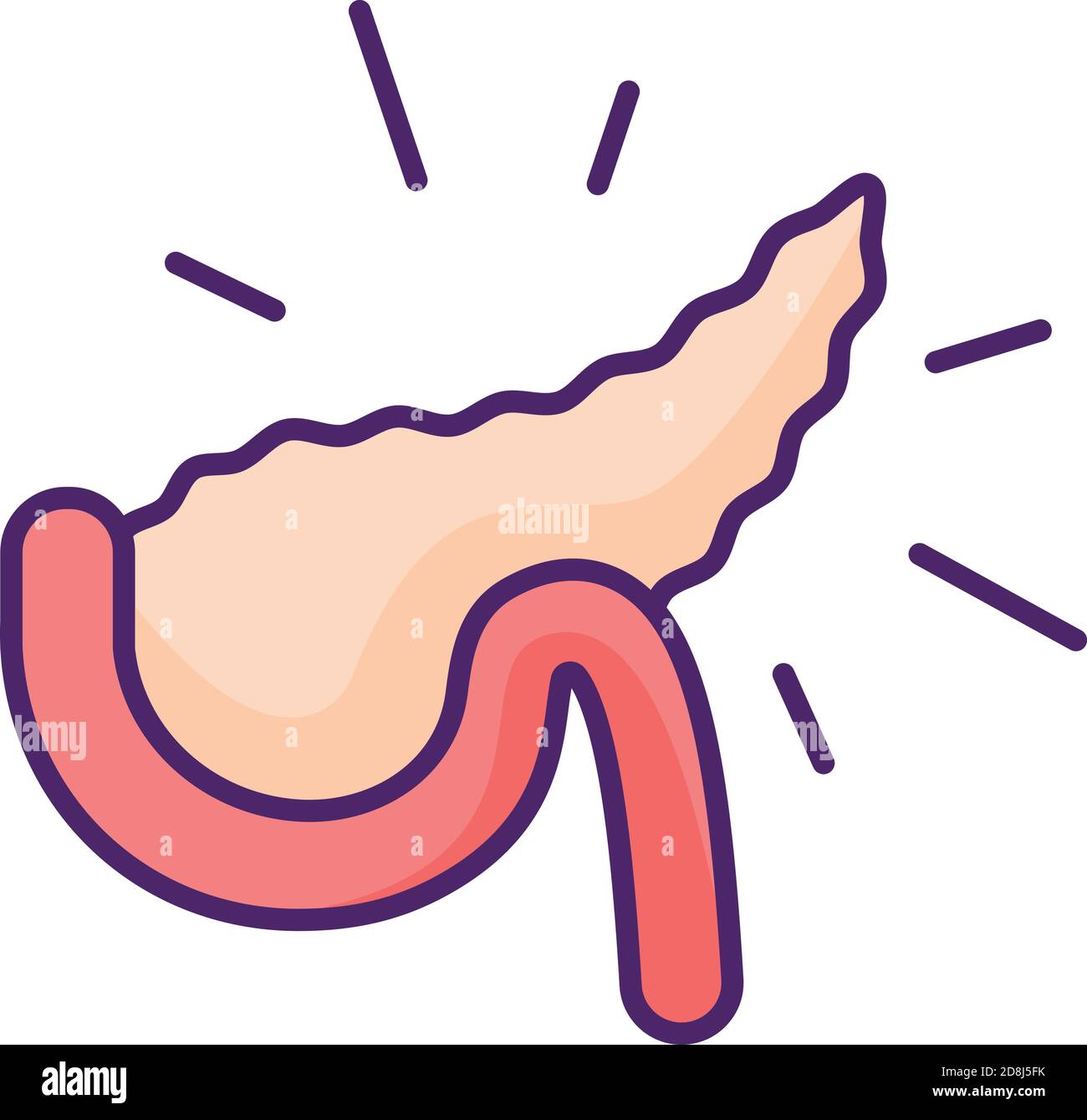 Pancreatitis inflammation Stock Vector Images - Alamy