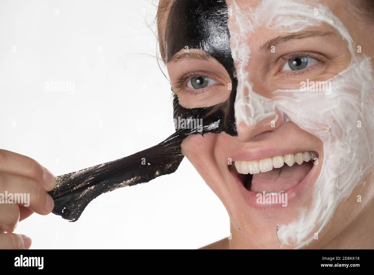 Happy beautiful girl with acne smiling on a white background in a ...