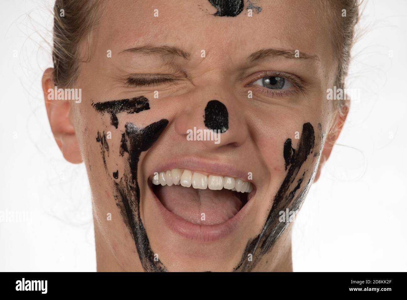 Happy beautiful girl with acne smiling on a white background in a ...