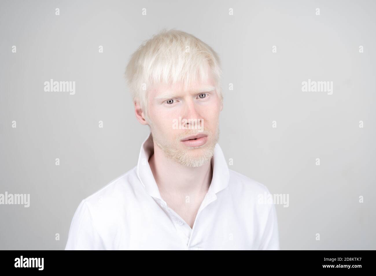 albinism albino man in studio dressed t-shirt isolated on a white ...
