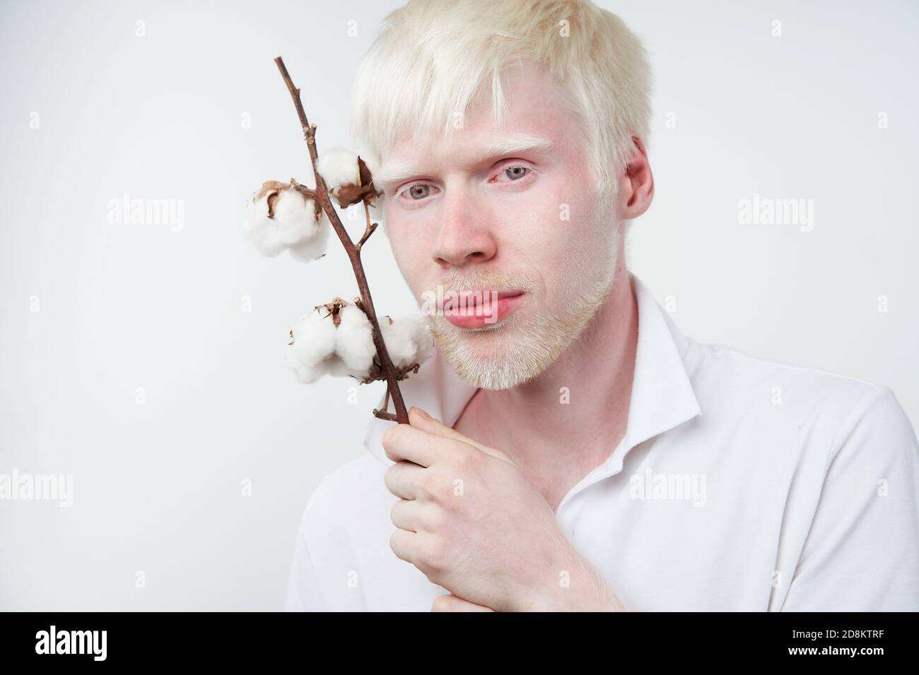 albinism Happy smile albino man white skin hair soft fluffy cotton ...
