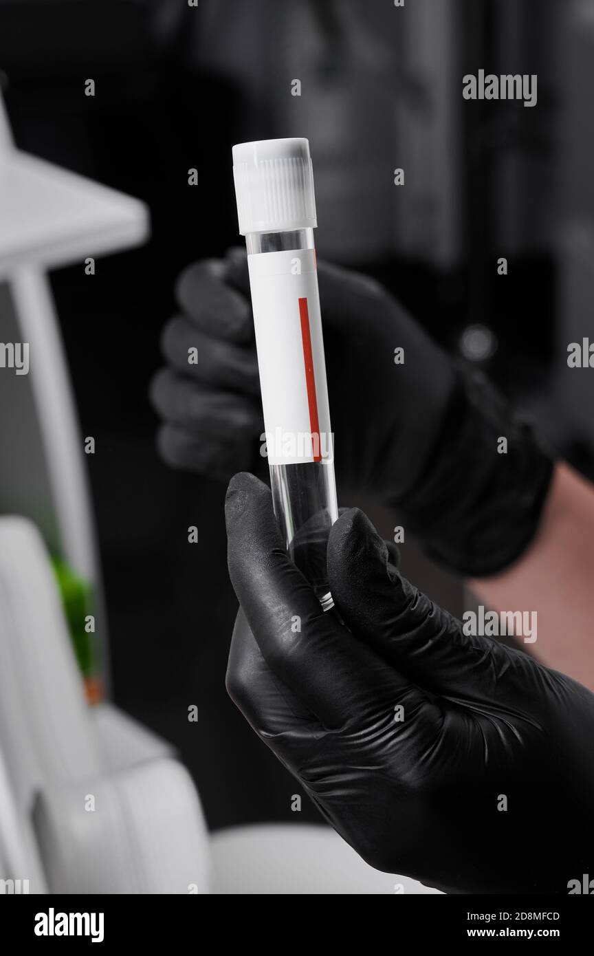 Close up of medical worker hands in black gloves holding laboratory ...