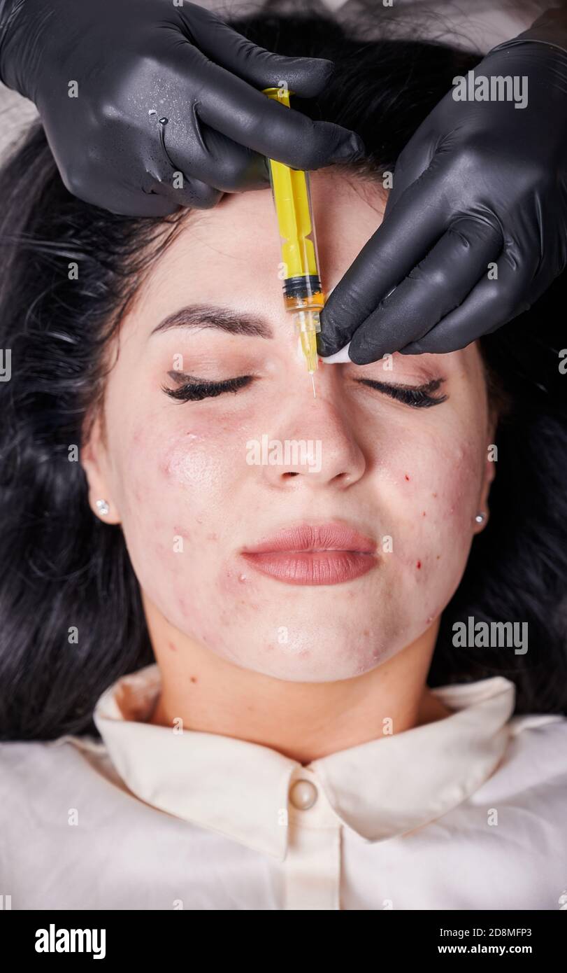 Close up of female patient with problematic skin receiving injections ...