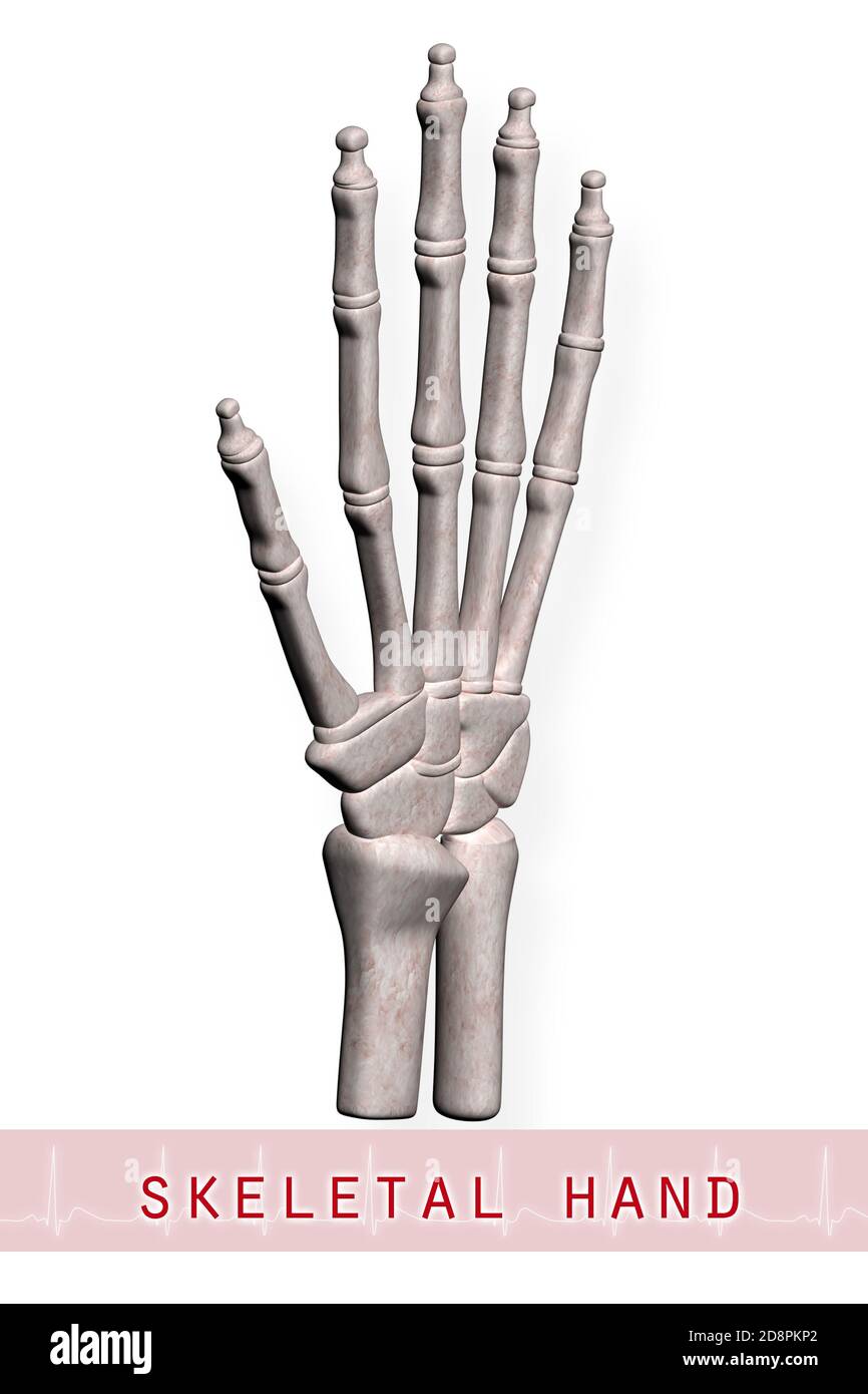 Ray hand arthritis Cut Out Stock Images & Pictures - Alamy