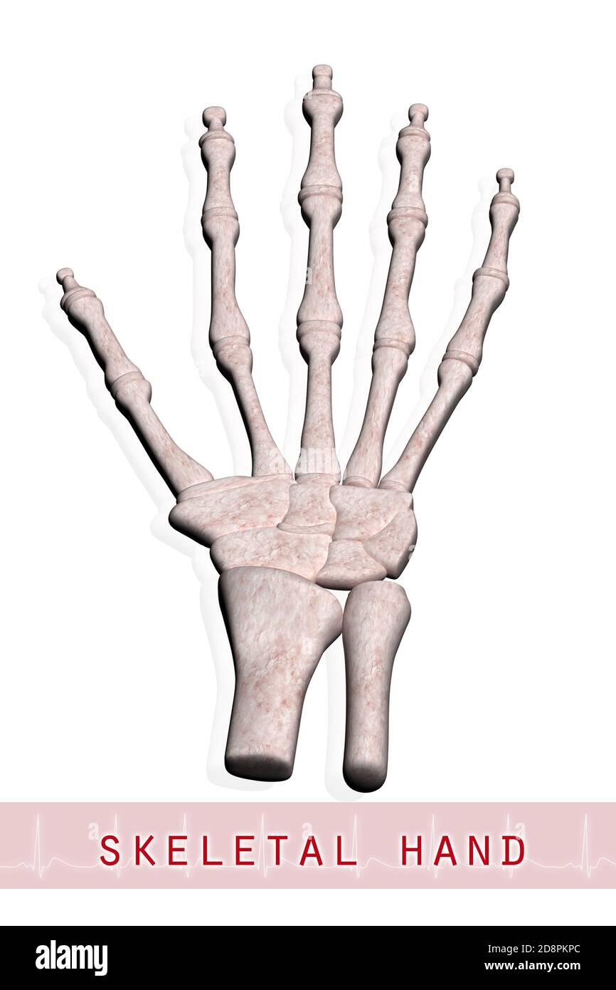 Ray hand arthritis Cut Out Stock Images & Pictures - Alamy