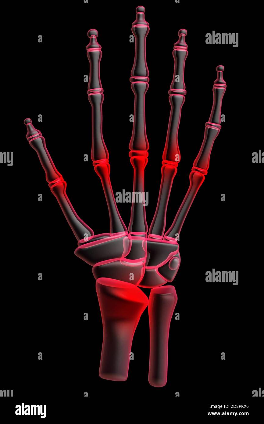 3d human hand pain Stock Photo - Alamy