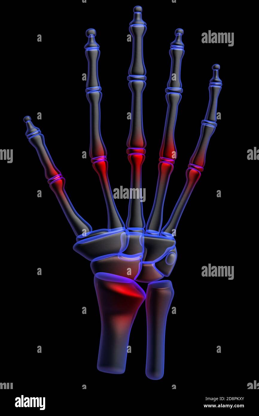 3d human hand pain Stock Photo - Alamy