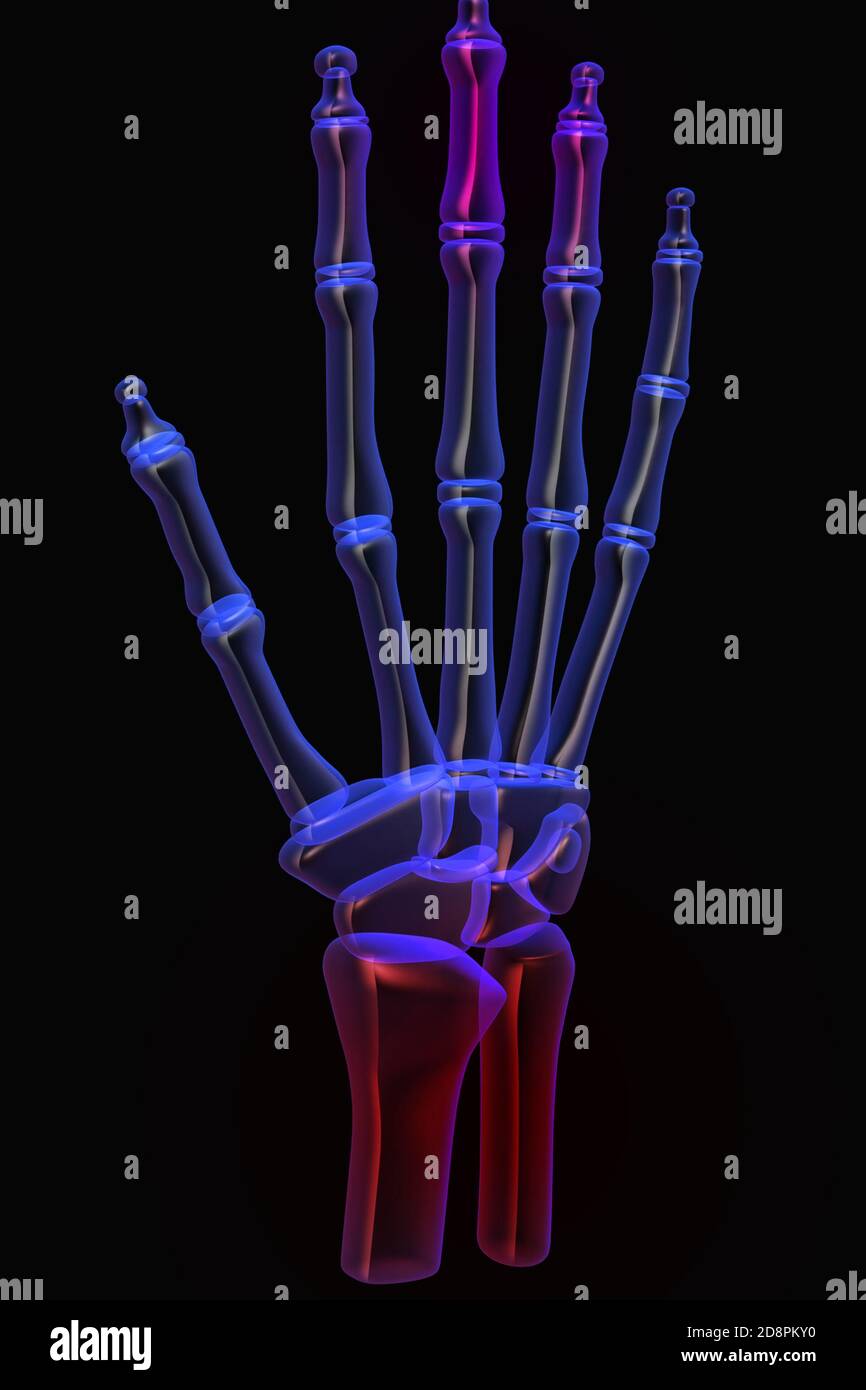 3d human hand pain Stock Photo - Alamy