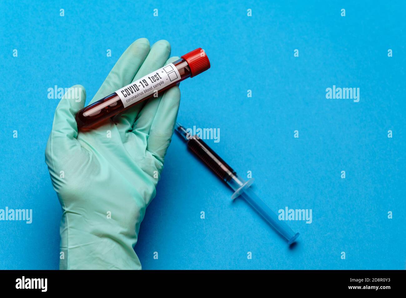 lab technician assistant or doctor holding a blood sample in test tube ...