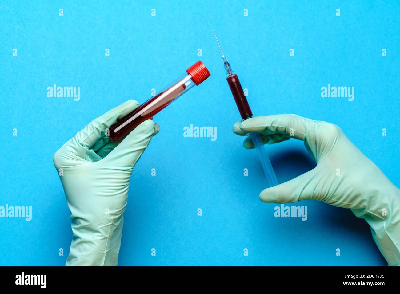 lab technician assistant or doctor holding a blood sample in test tube ...