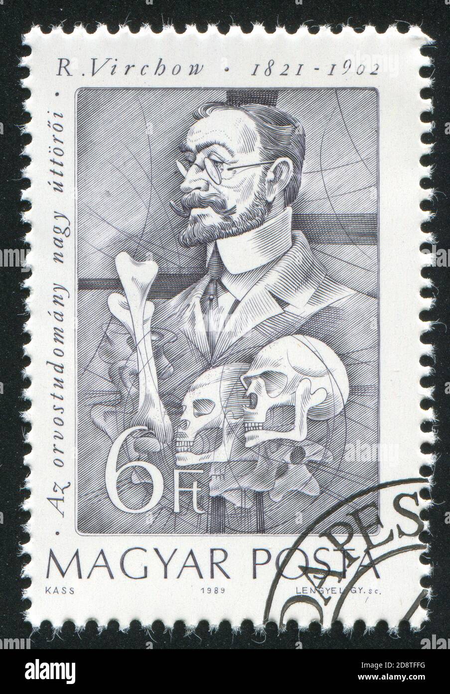 HUNGARY - CIRCA 1989: stamp printed by Hungary, shows Rudolf Virchow ...