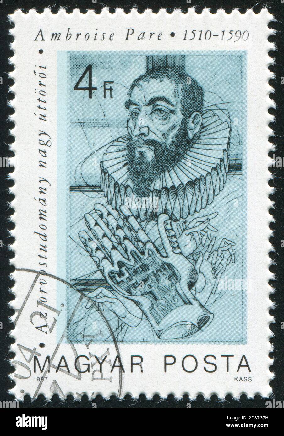 HUNGARY - CIRCA 1987: stamp printed by Hungary, shows Ambroise Pare ...