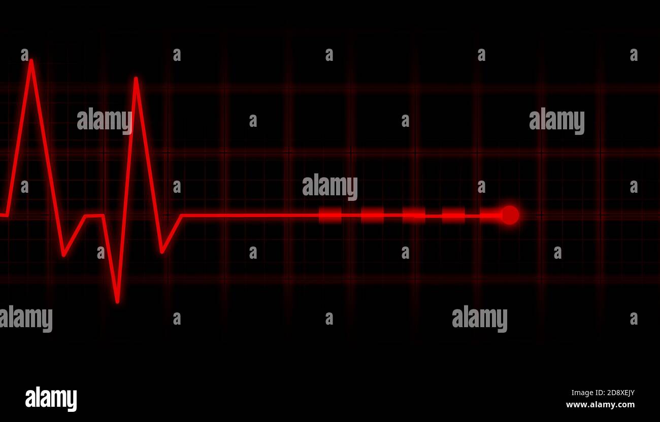 Normal ecg red background heartbeat hi-res stock photography and images ... Normal ecg red background heartbeat hi-res stock photography and images ...