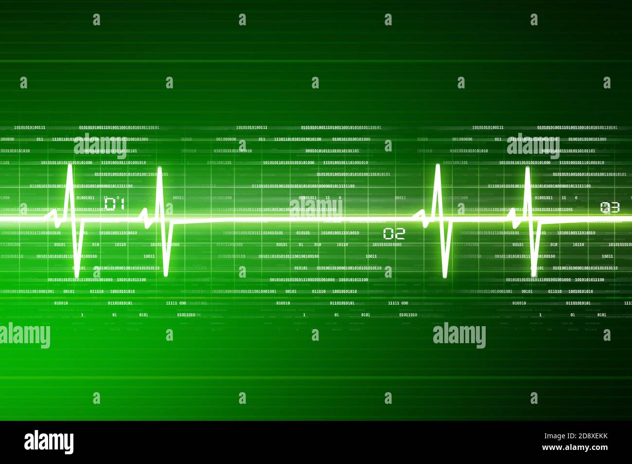 Page 2 - Normal Ecg High Resolution Stock Photography and Images - Alamy
