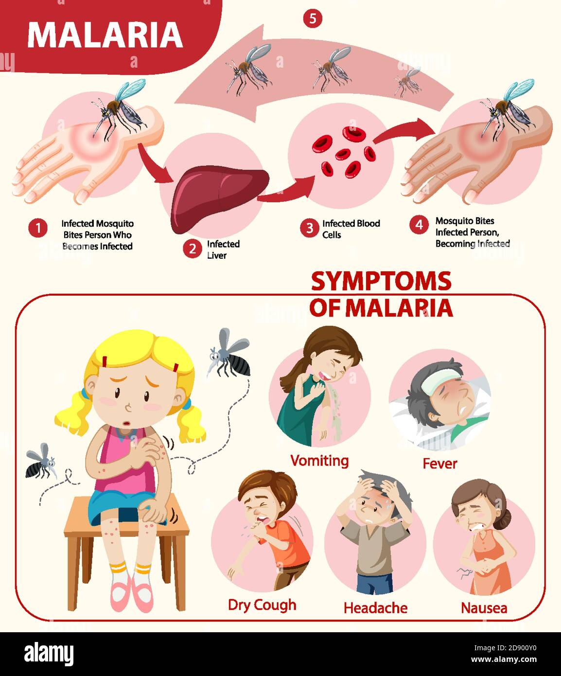 Malaria symptom information infographic illustration Stock Vector Image ...