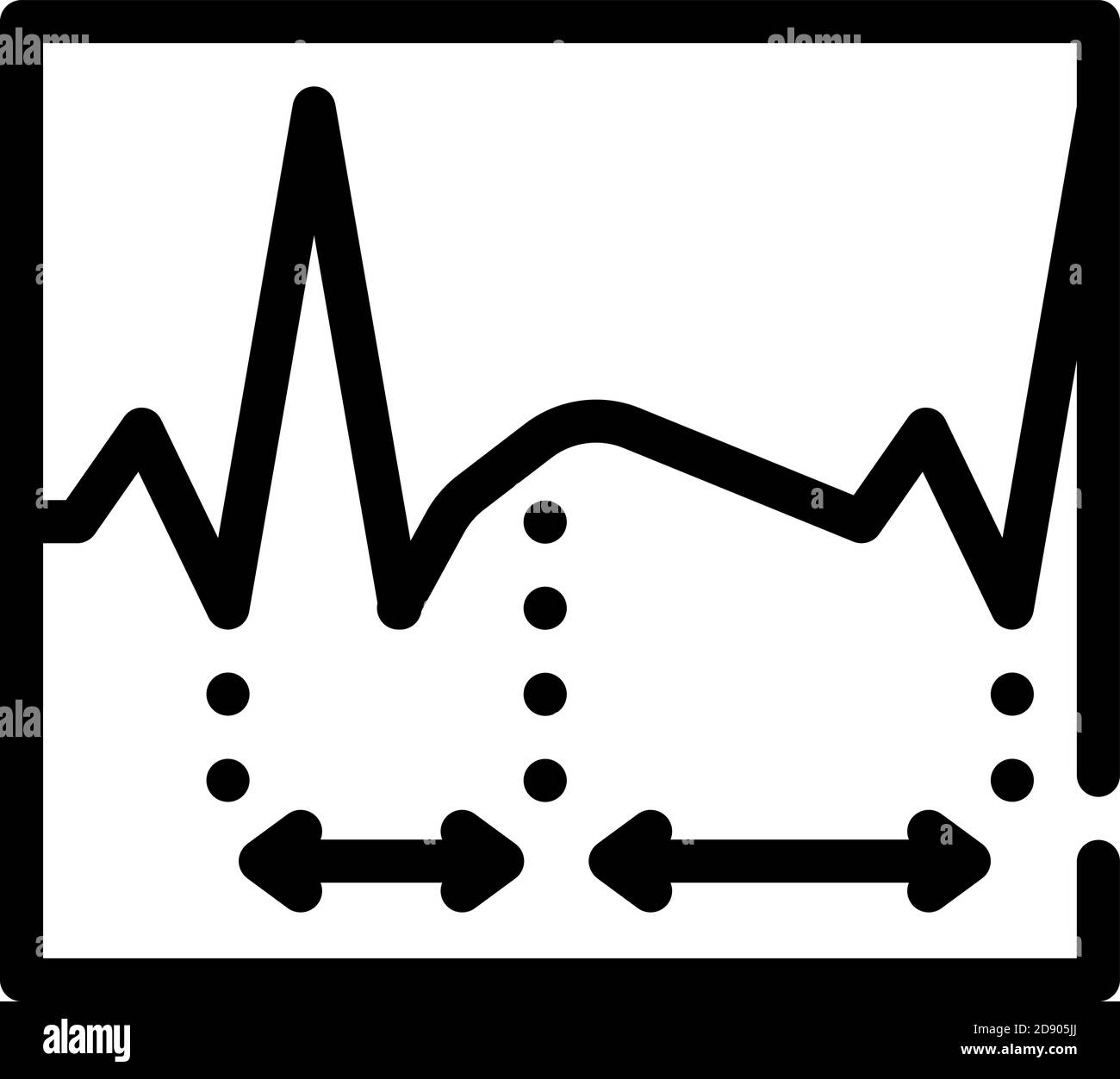 Diastole analysis sistal cardiogram hi-res stock photography and images ...