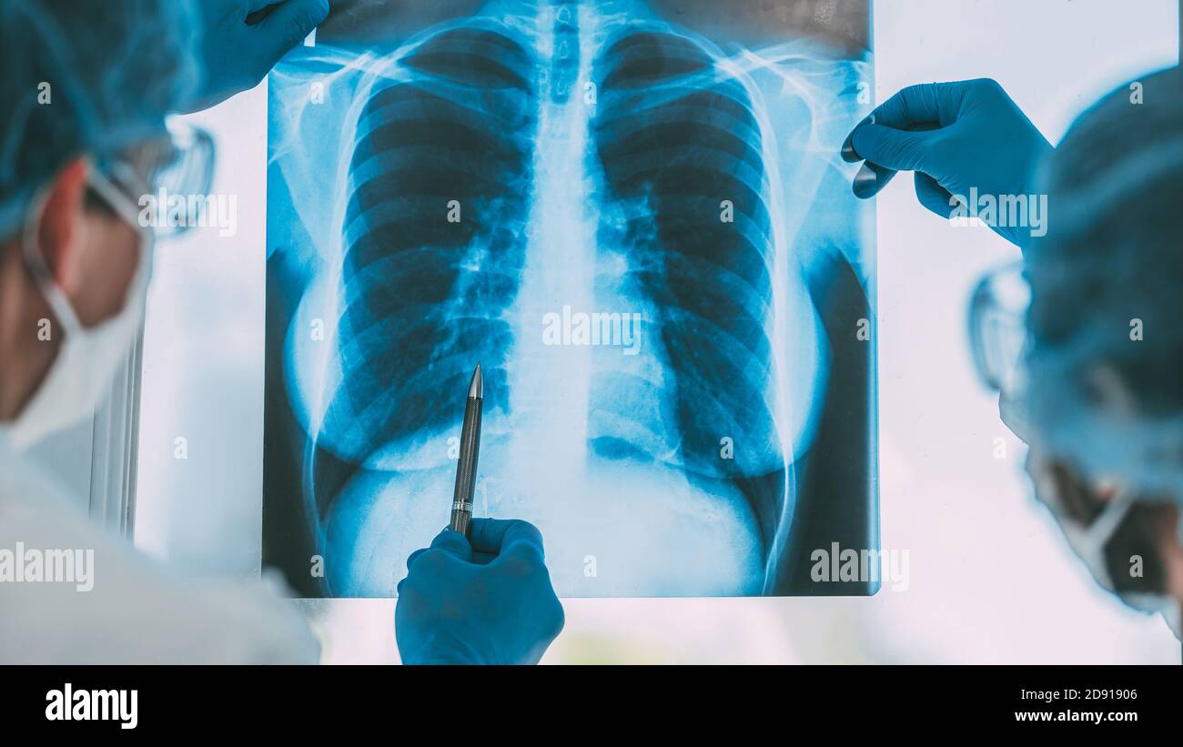close up. doctors in protective clothing discussing an x-ray of the ...
