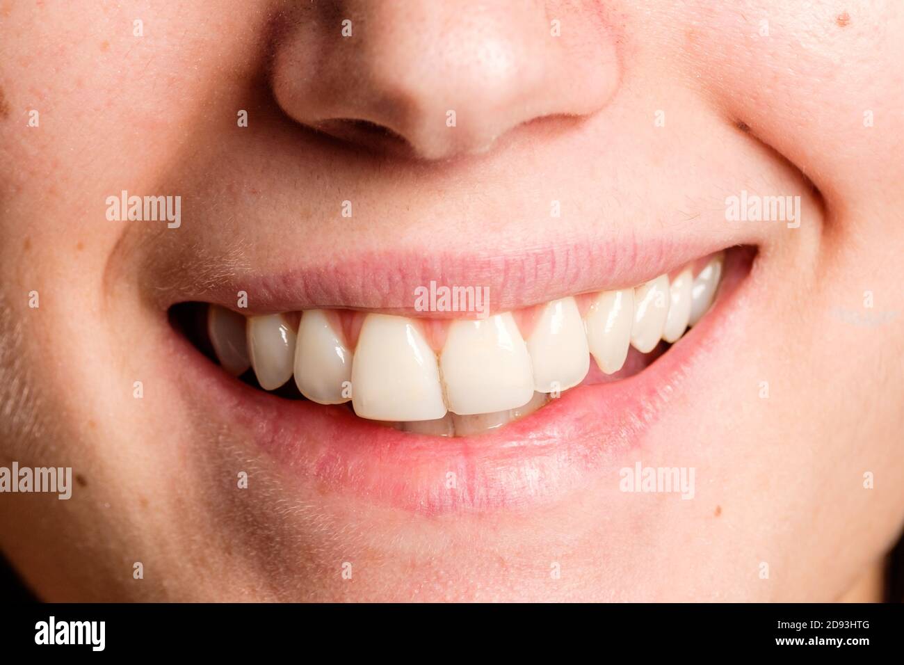 image of a woman mouth smiling Stock Photo - Alamy
