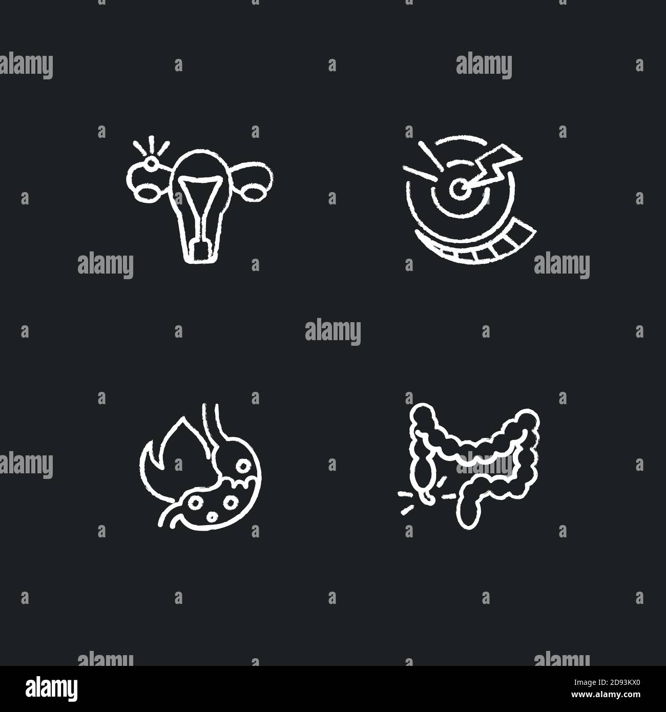 Abdominal inflammation chalk white icons set on black background Stock ...