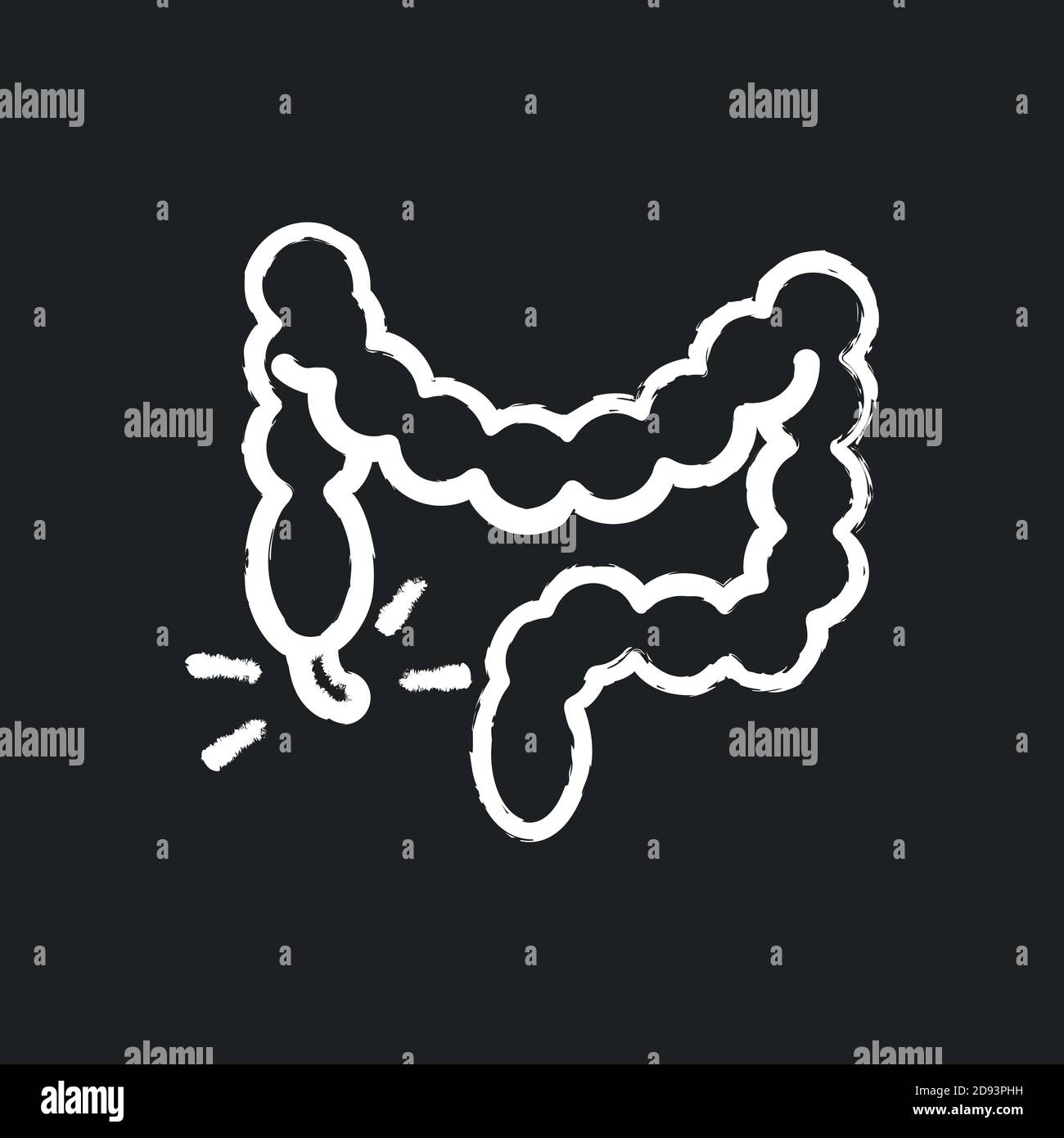 Appendicitis sketch hi-res stock photography and images - Alamy