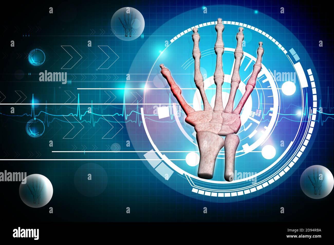 X ray wrist medical skeleton biology science anatomical hi-res stock ...