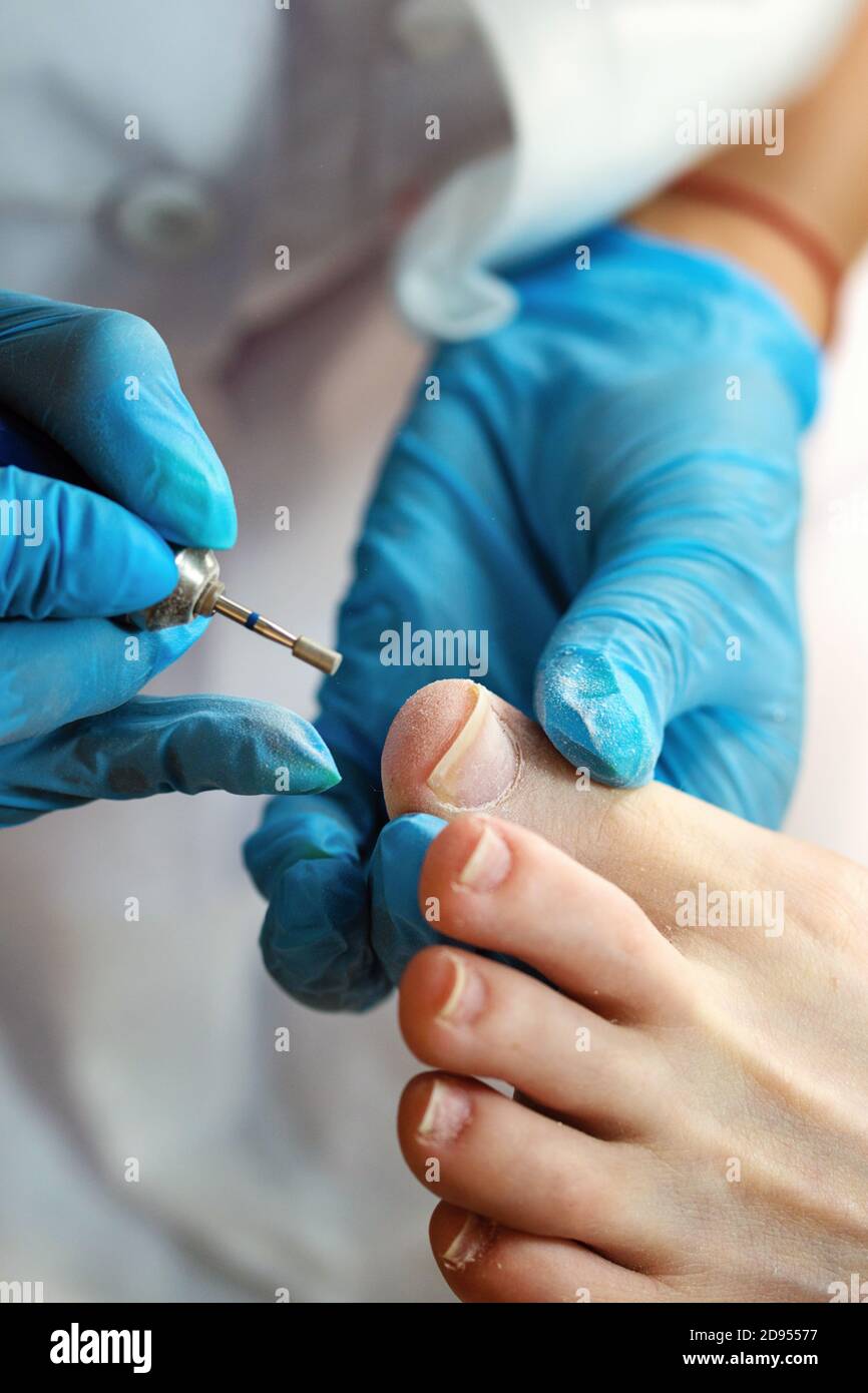 Hardware pedicure, preparation of the nail plate for applying gel ...