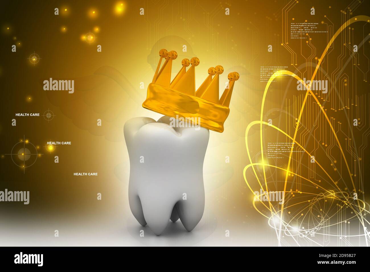 tooth In Golden Crown Stock Photo - Alamy