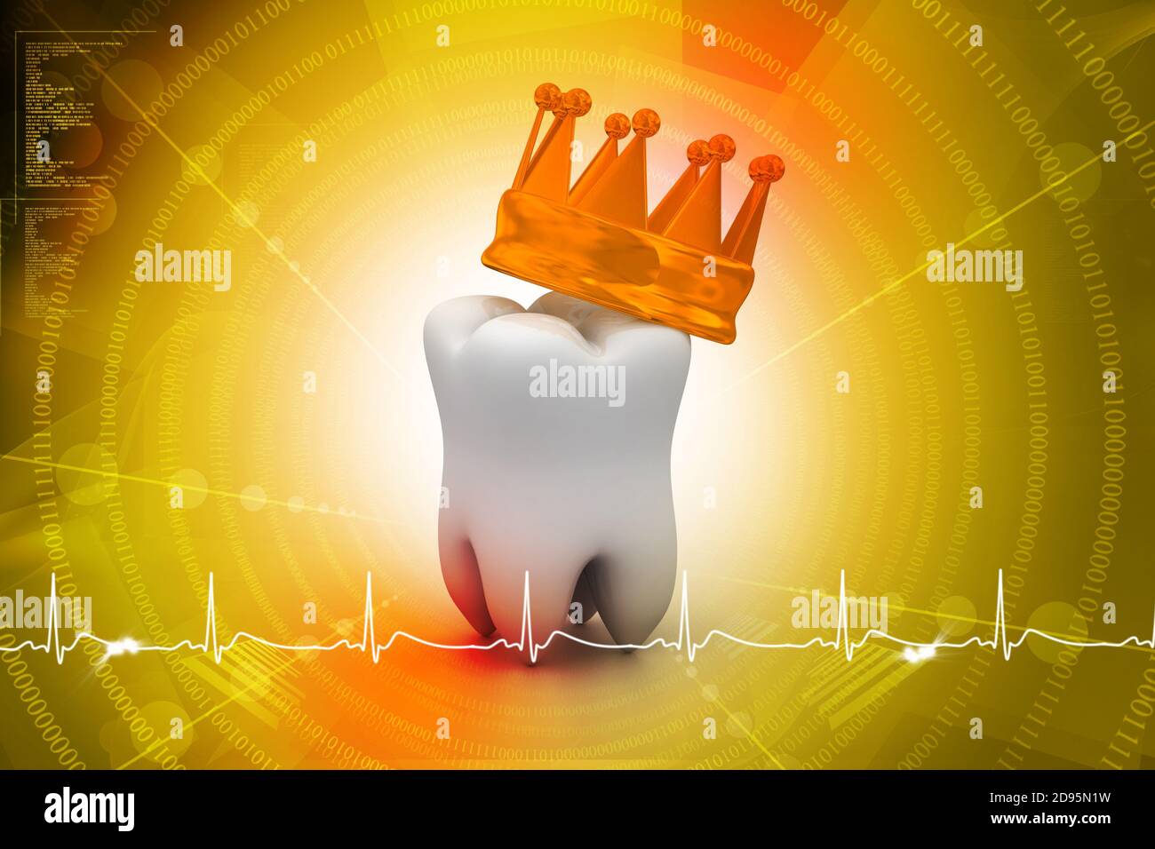 tooth In Golden Crown Stock Photo - Alamy