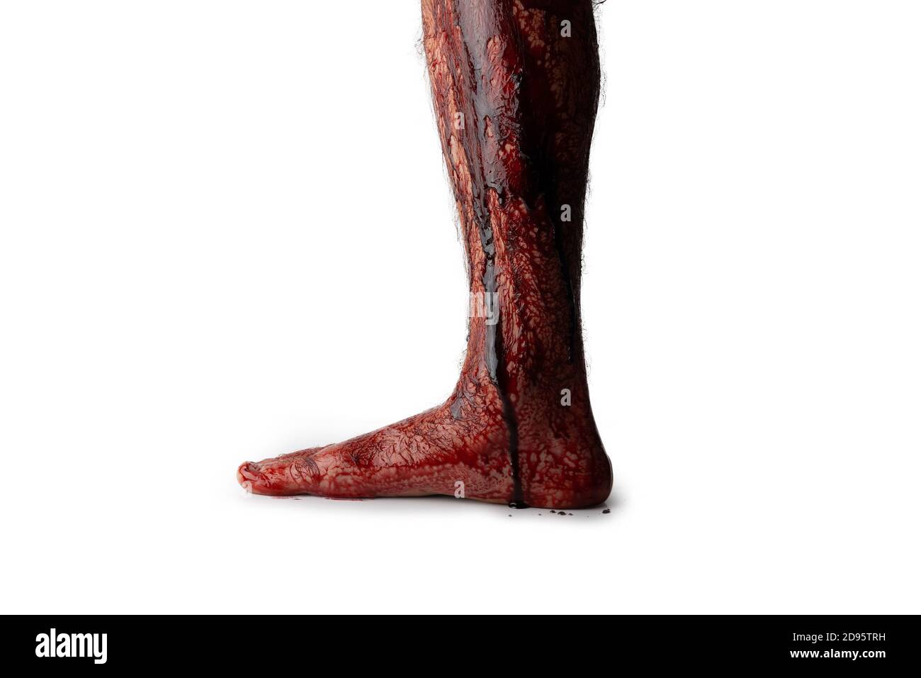 Arterial bleeding hi-res stock photography and images - Alamy