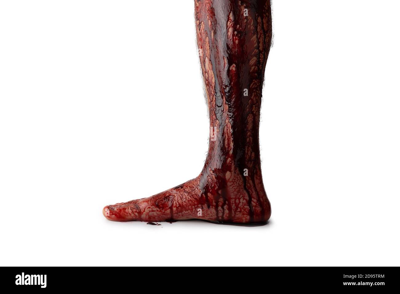 Arterial bleeding man hi-res stock photography and images - Alamy