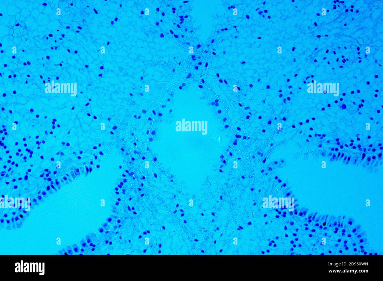 Histology Ovary High Resolution Stock Photography and Images - Alamy
