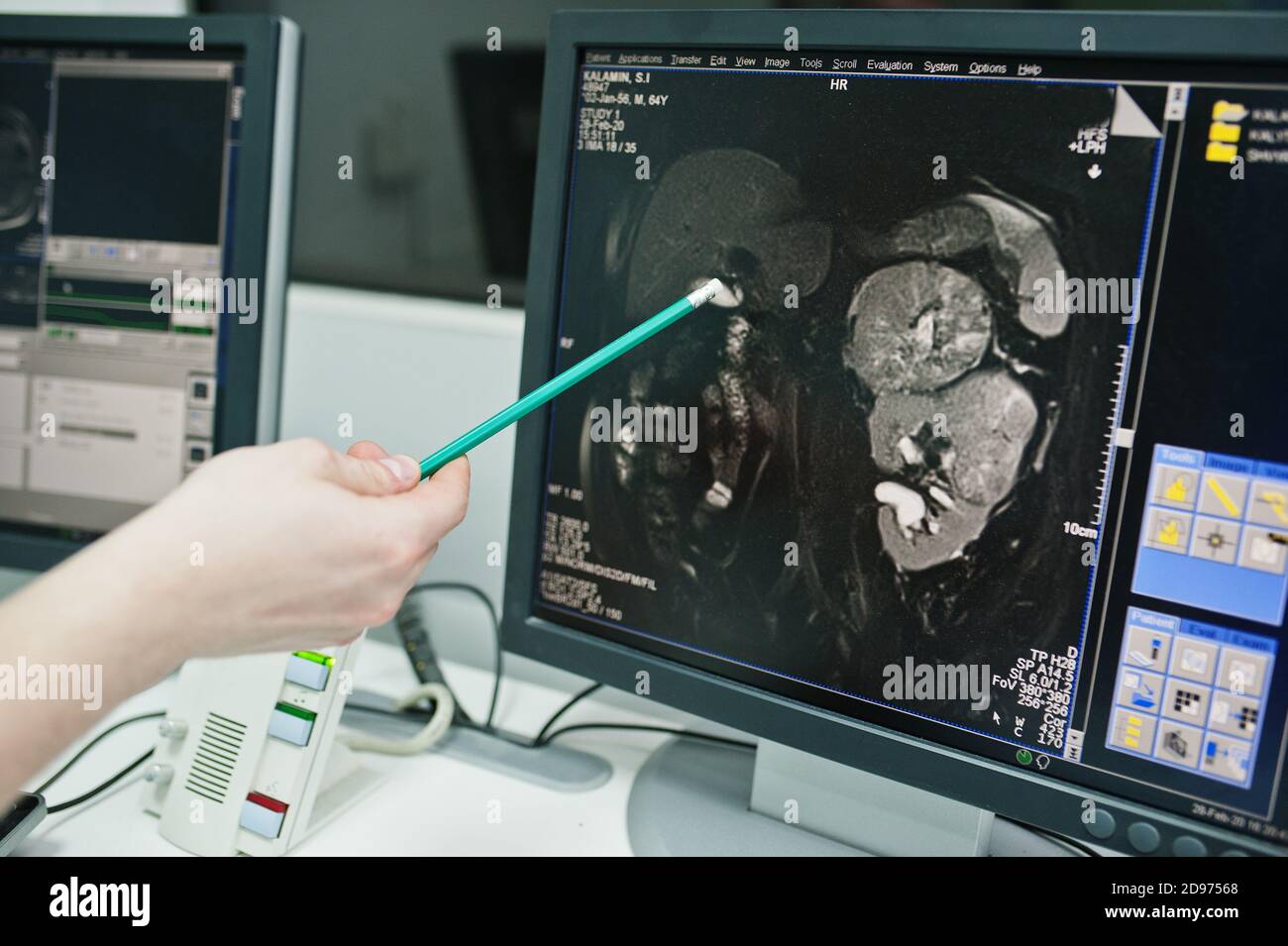 Medical theme. Diagnostic mri center in hospital, monitors of computer ...