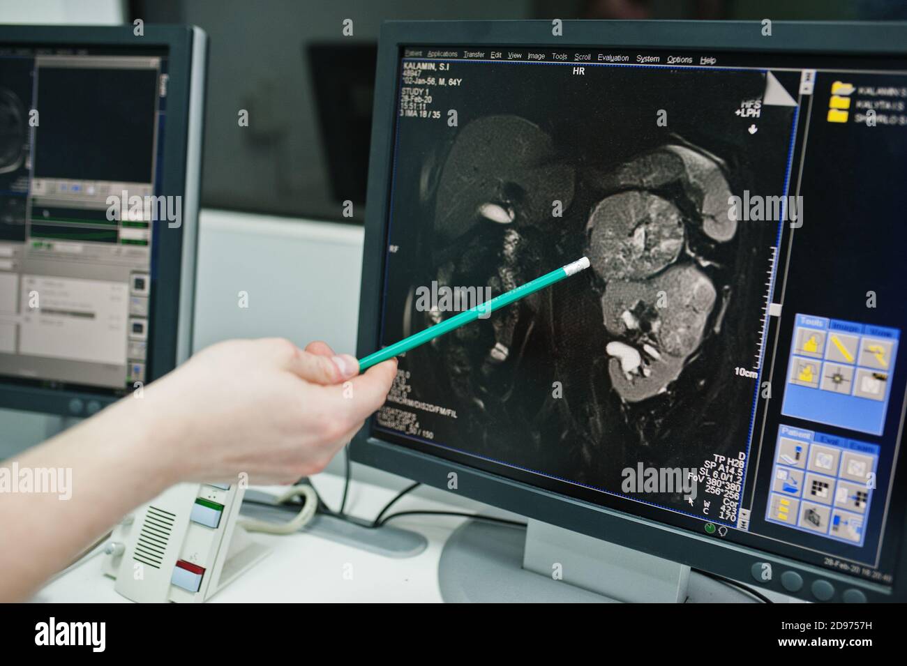 Medical theme. Diagnostic mri center in hospital, monitors of computer ...