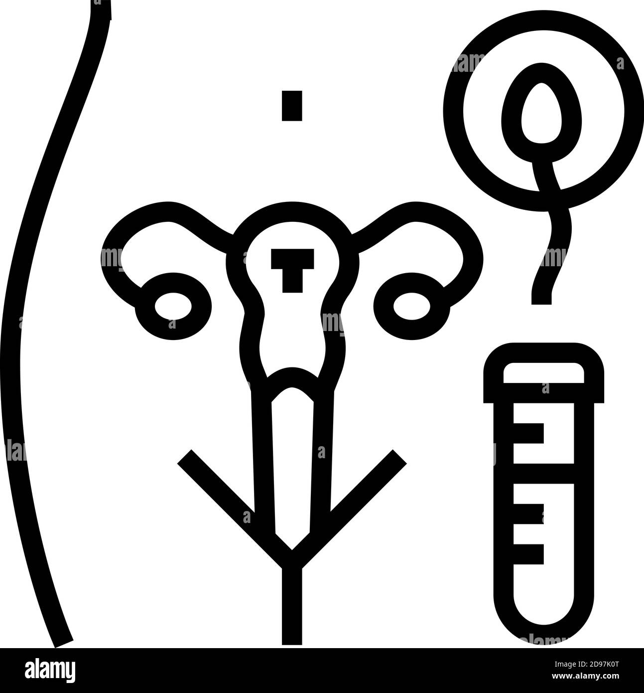 Artificial Insemination