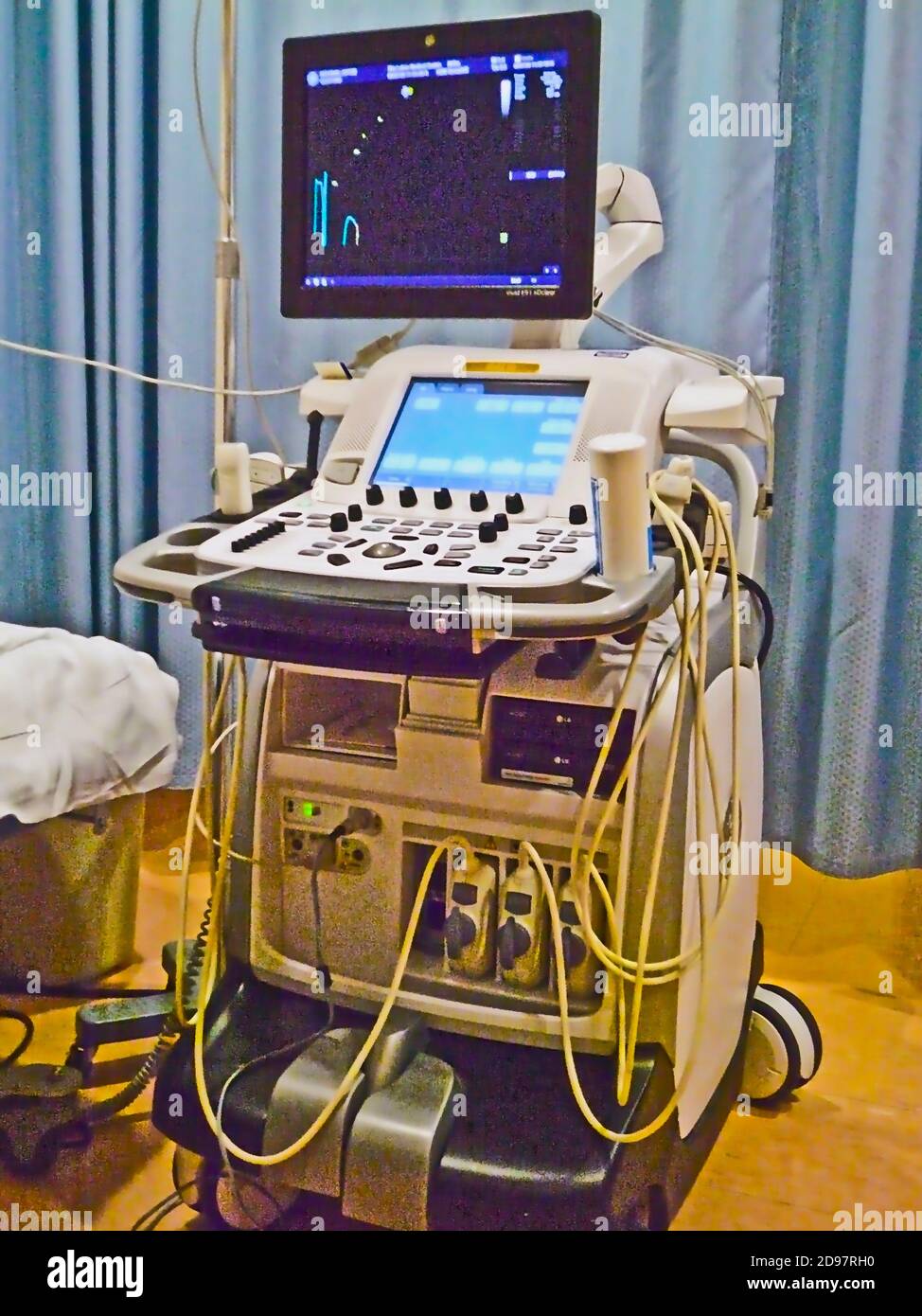 Parts Of Echocardiography Machine at Amy Whitehurst blog