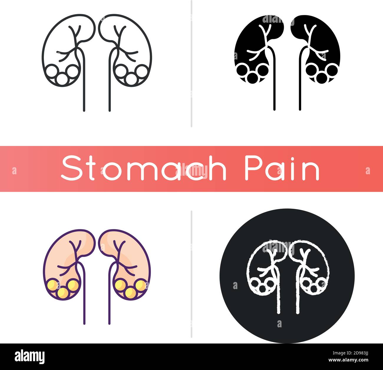 Kidney stone disease renal Stock Vector Images - Alamy