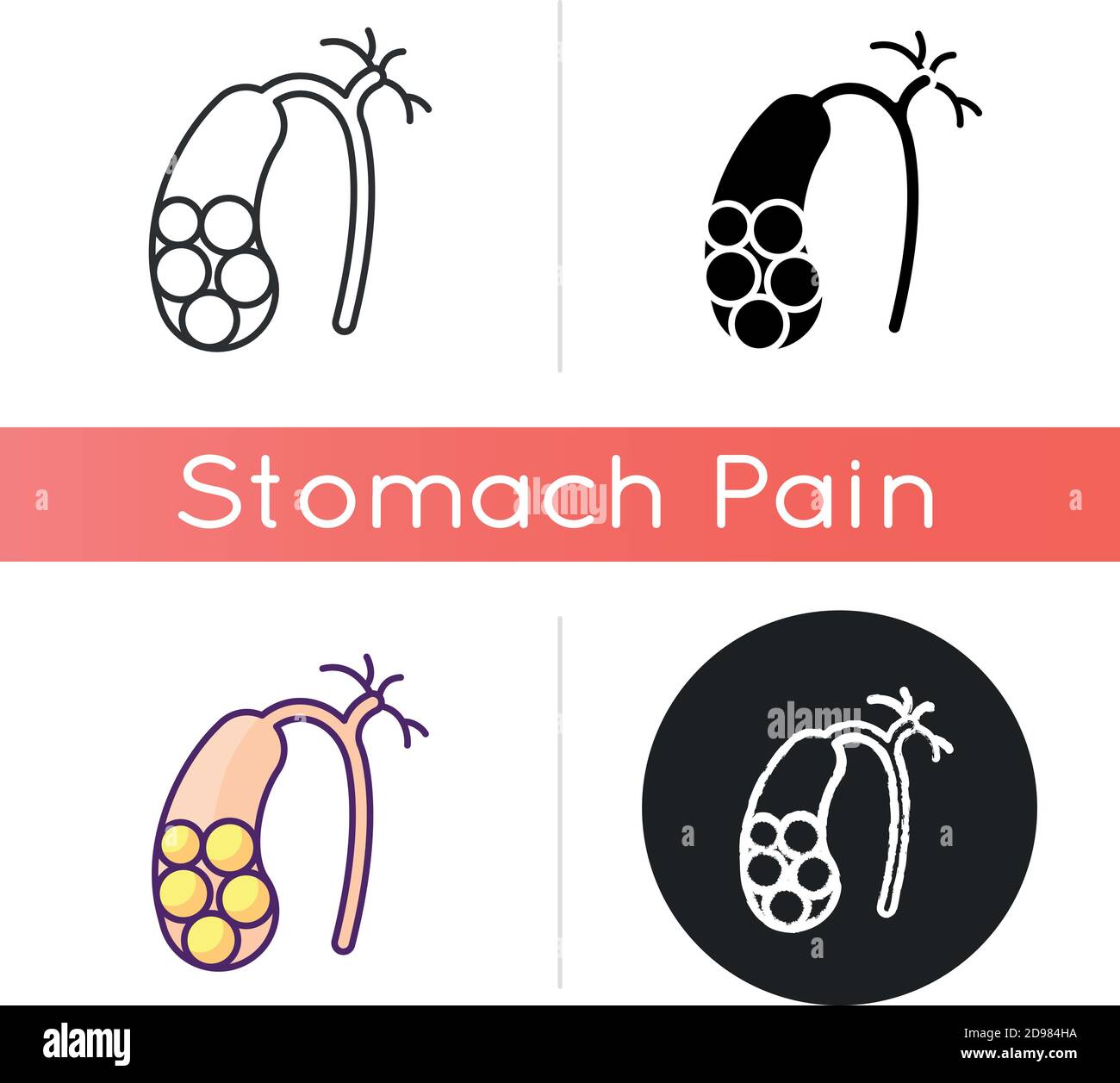 Gallstones Stock Vector Images - Alamy