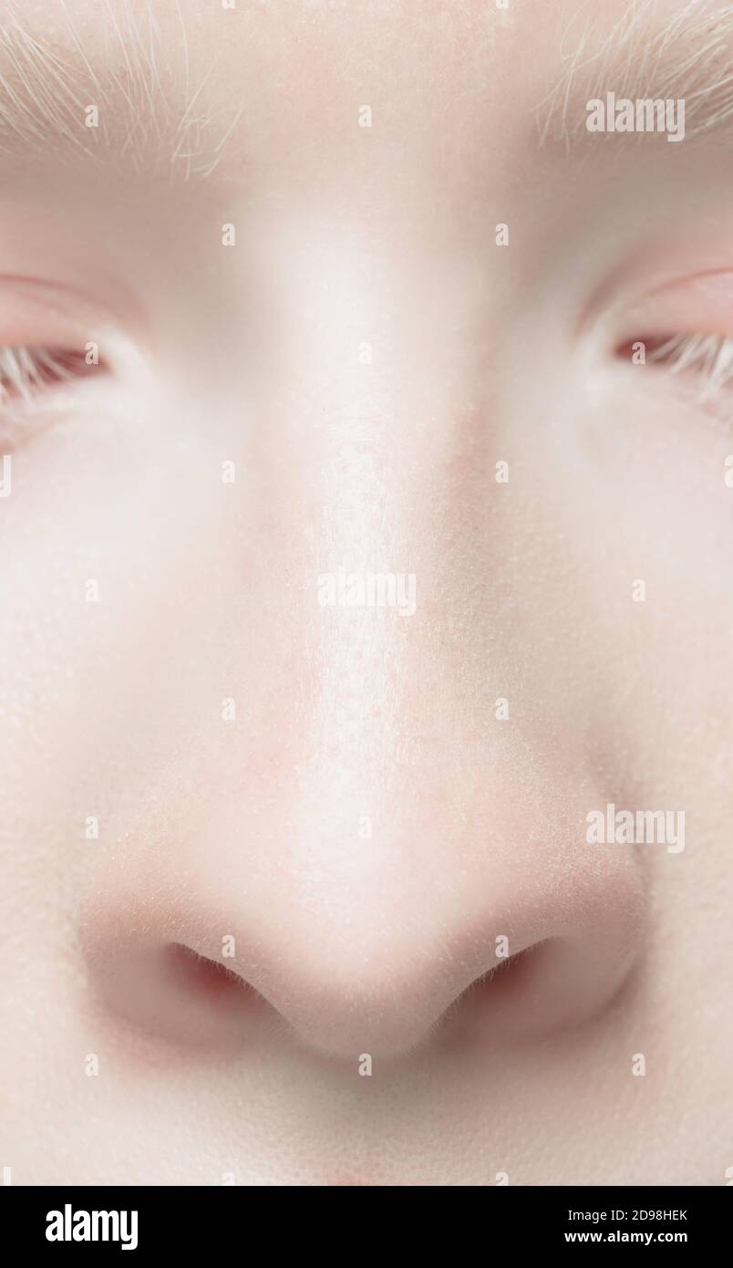 Nose and eyelid. Close up portrait of beautiful albino female model ...