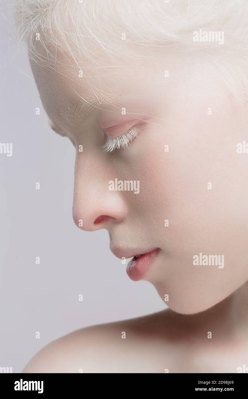 Profile. Close up portrait of beautiful albino female model. Parts of ...