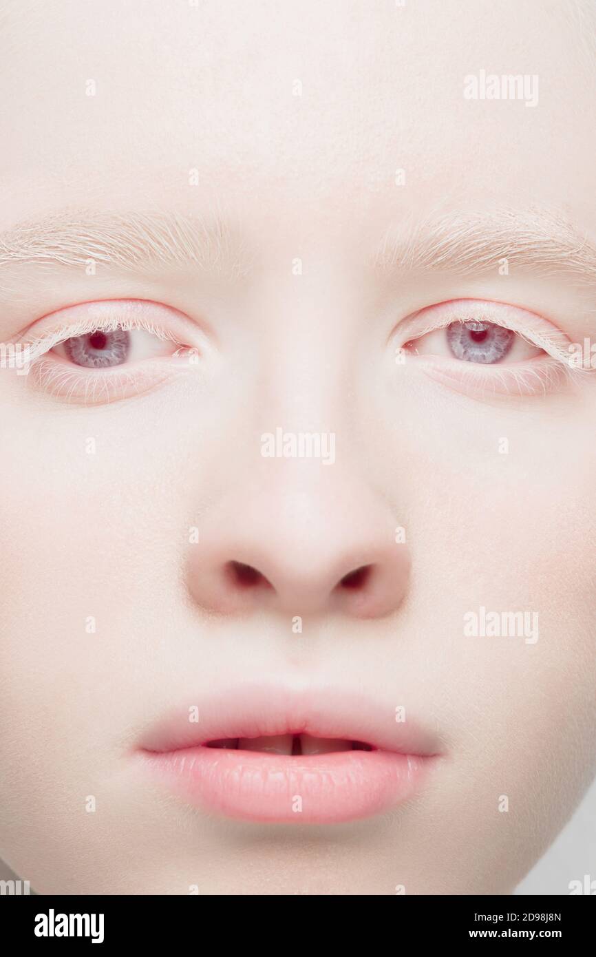 Eyes open. Close up portrait of beautiful albino female model. Parts of ...