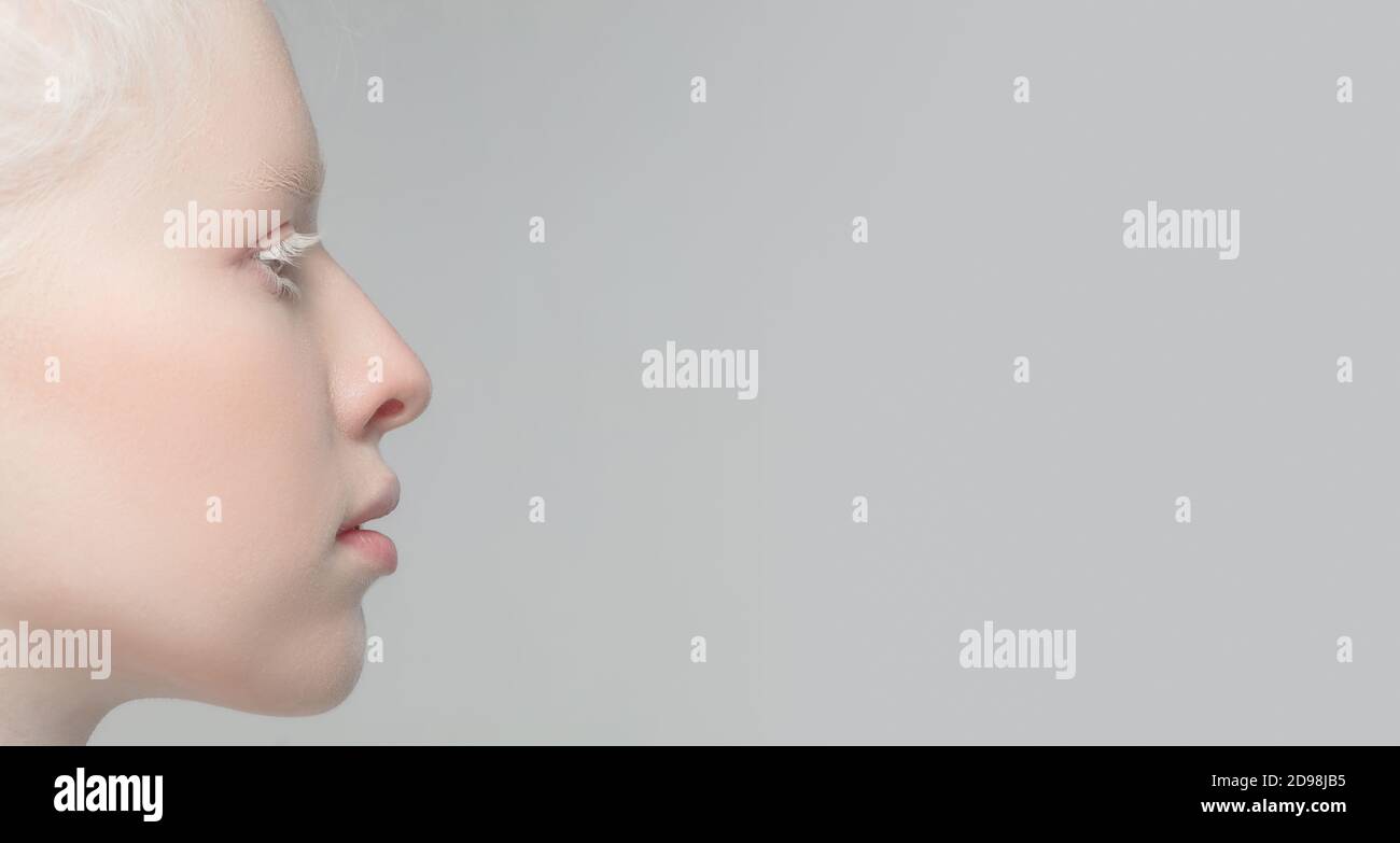 Profile, flyer. Close up portrait of beautiful albino female model ...