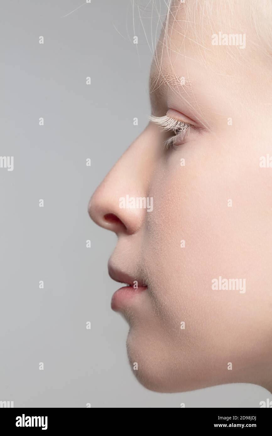 Profile. Close up portrait of beautiful albino female model. Parts of ...