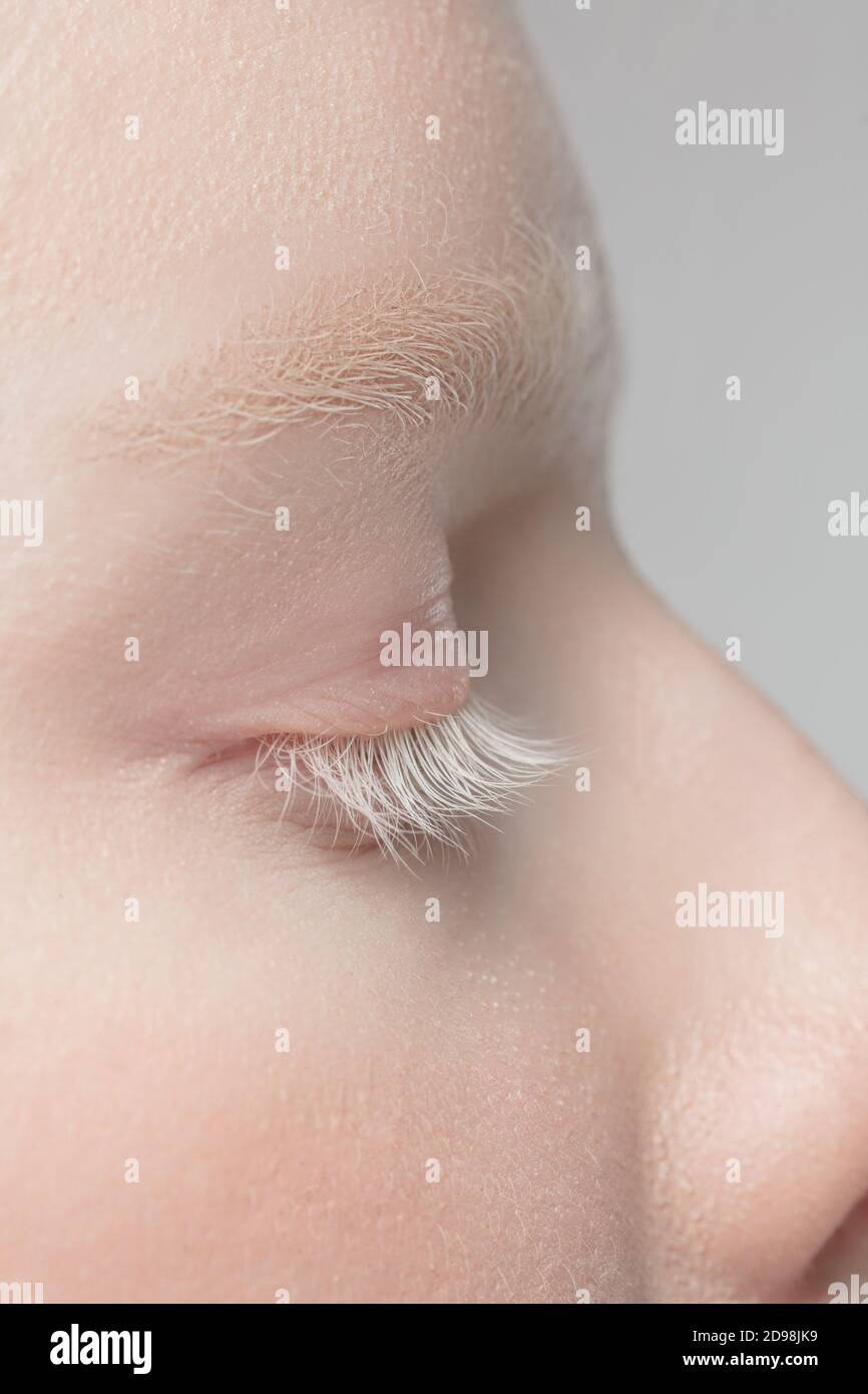 Nose and eyelid. Close up portrait of beautiful albino female model ...