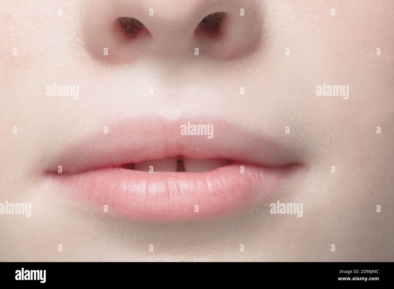 Lips and teeth. Close up portrait of beautiful albino female model ...